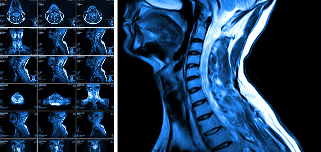 Upright Open MRI - Florida MRI - MDN Group MRI Center