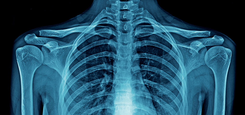 X-Ray - Florida MRI - MDN Group MRI Center